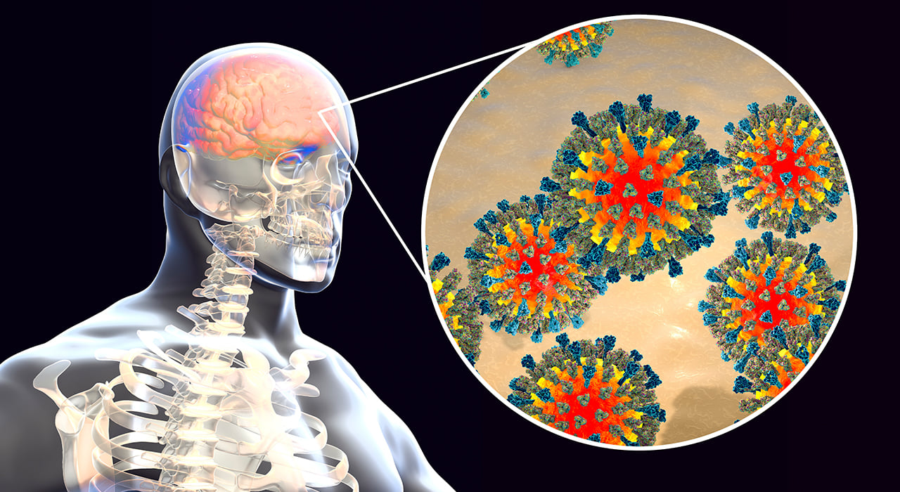 Infecciones Del Sistema Nervioso Coggle Diagram - vrogue.co Infecciones Del Sistema Nervioso Coggle Diagram - vrogue.co