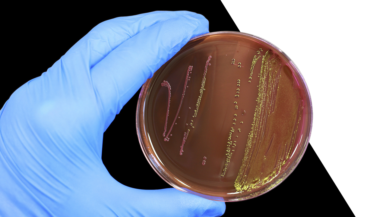 Master's Degree in Public Health - TECH Australia