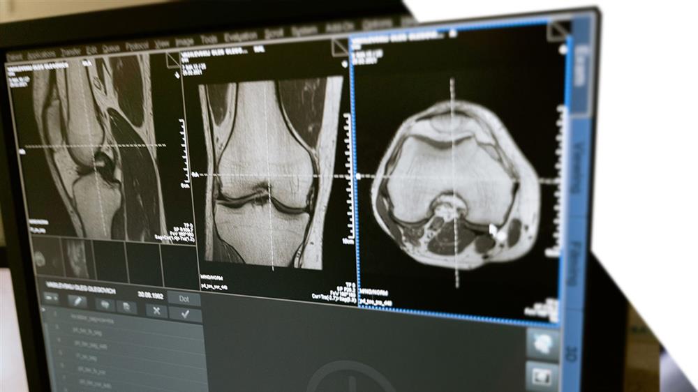 Curso Universitario en Resonancia Magnética para Enfermería - TECH España