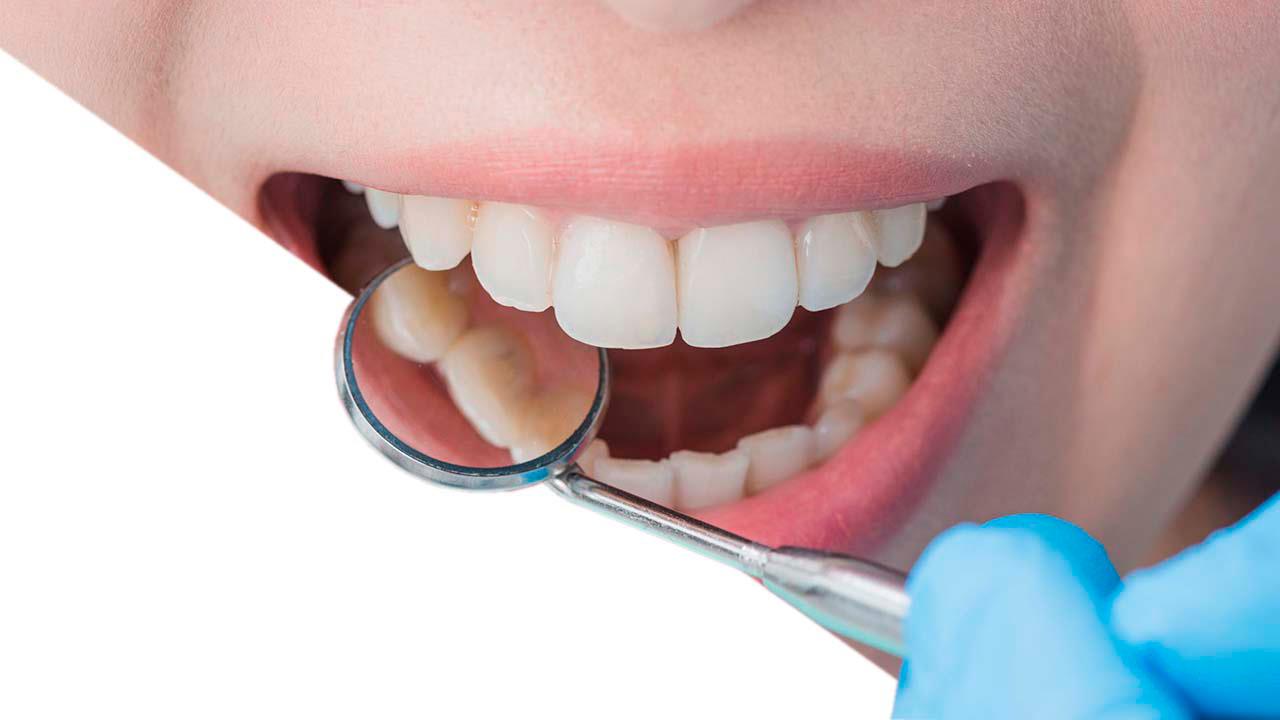 Capacitación Práctica En Odontología Estética Adhesiva Tech España